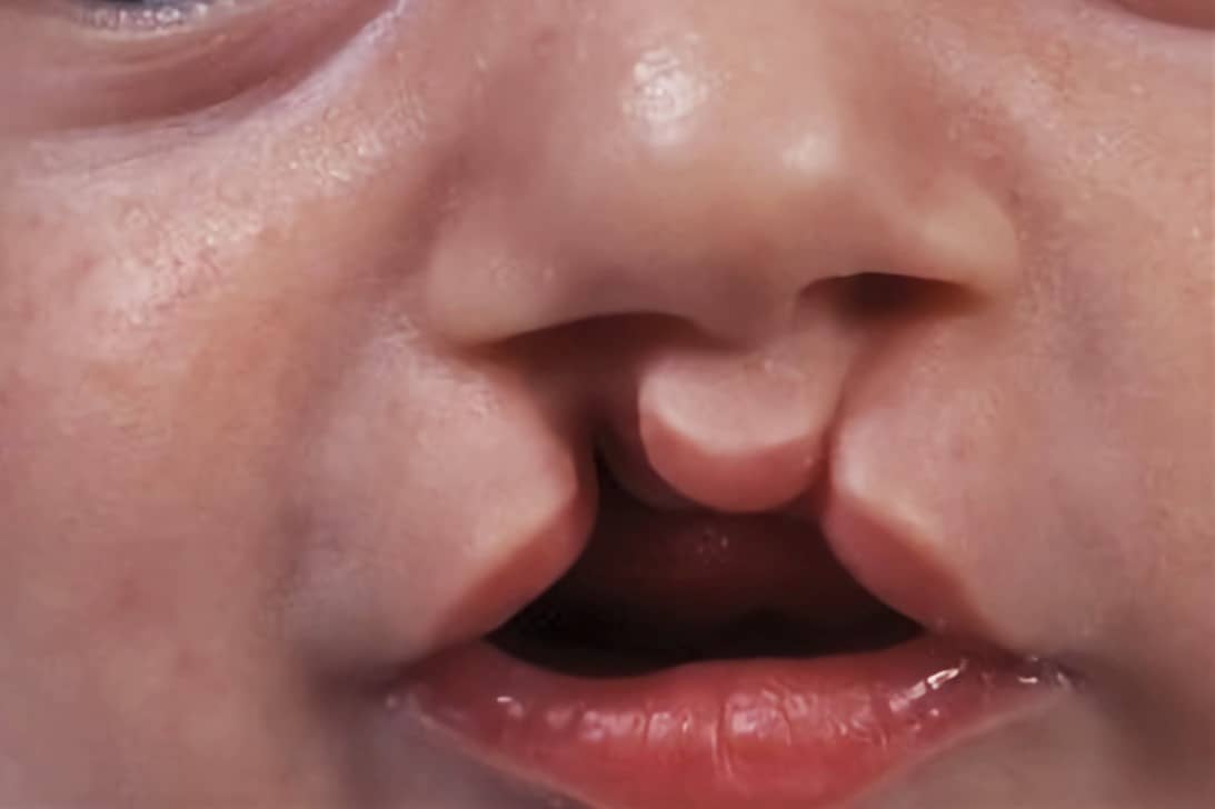 Con tu sonrisa, rompe el Récord Guinness y recauda fondos para operar a ...